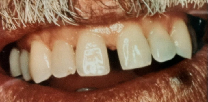 Dentist in Ann Arbor, MI - Smile Gallery Shiva G. Rad, D.D.S. | Before ... Dentist in Ann Arbor, MI - Smile Gallery Shiva G. Rad, D.D.S. | Before ...